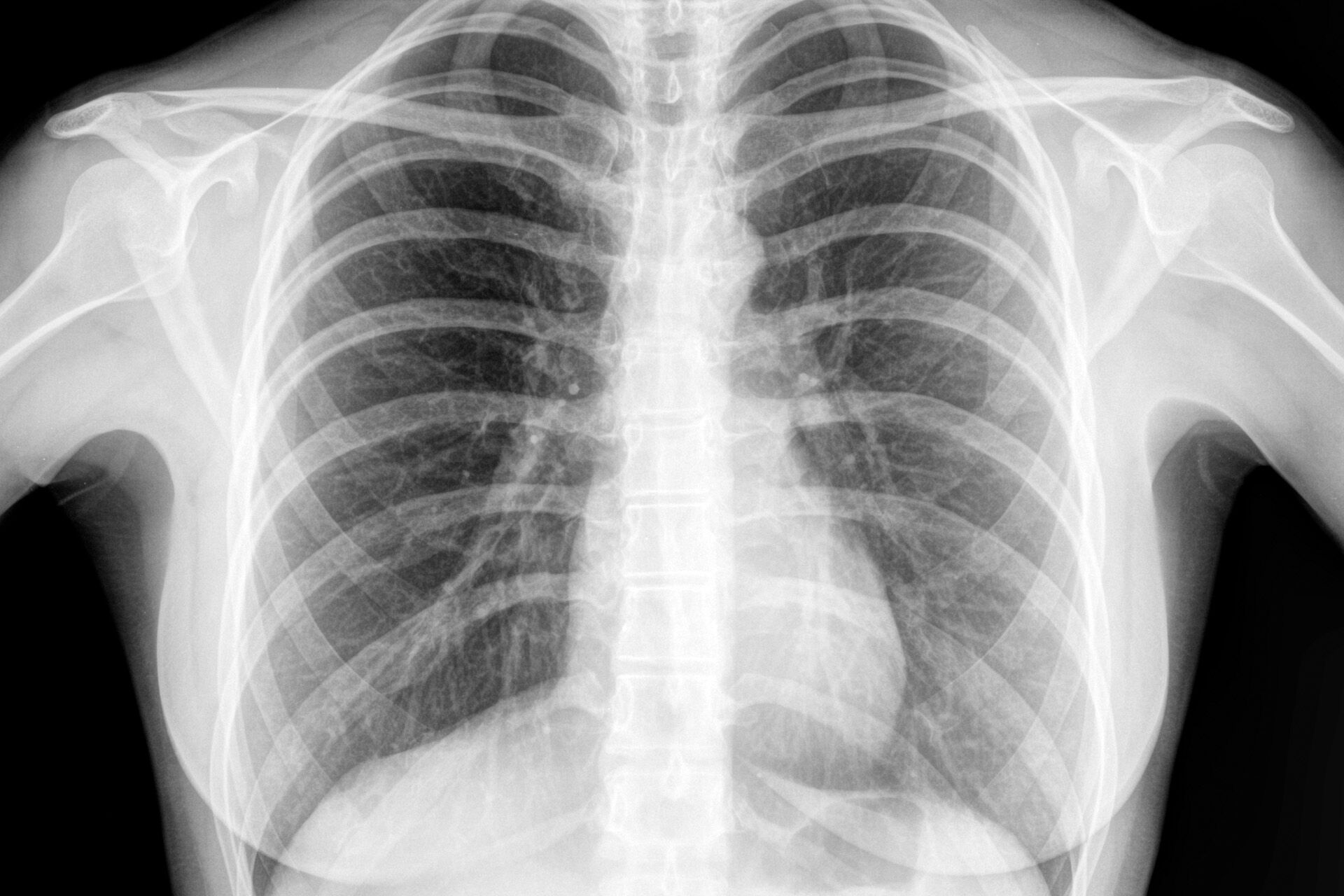 Afrirad Medical Imaging | Diagnostic Radiological Services